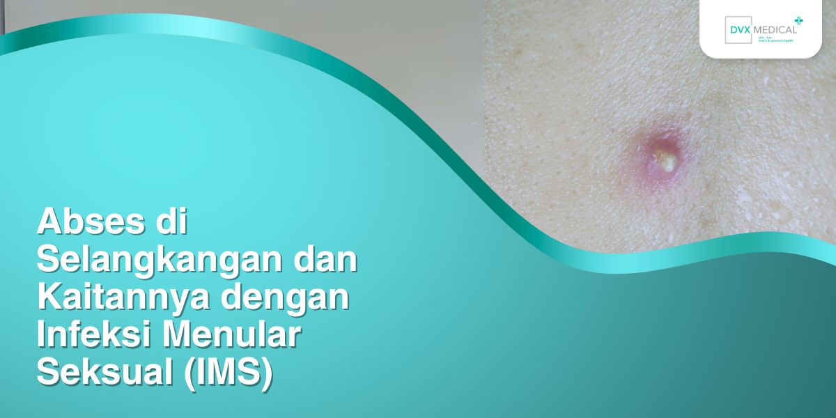 Abses Di Selangkangan Dan Kaitannya Dengan Infeksi Menular Seksual (IMS)