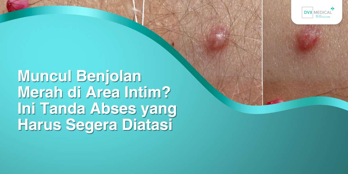 Muncul Benjolan Merah Di Area Intim? Ini Tanda Abses Yang Harus Segera ...